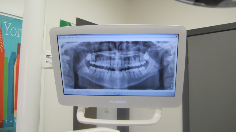 OPG – A Full Mouth X-Ray | Carlton Dental Care